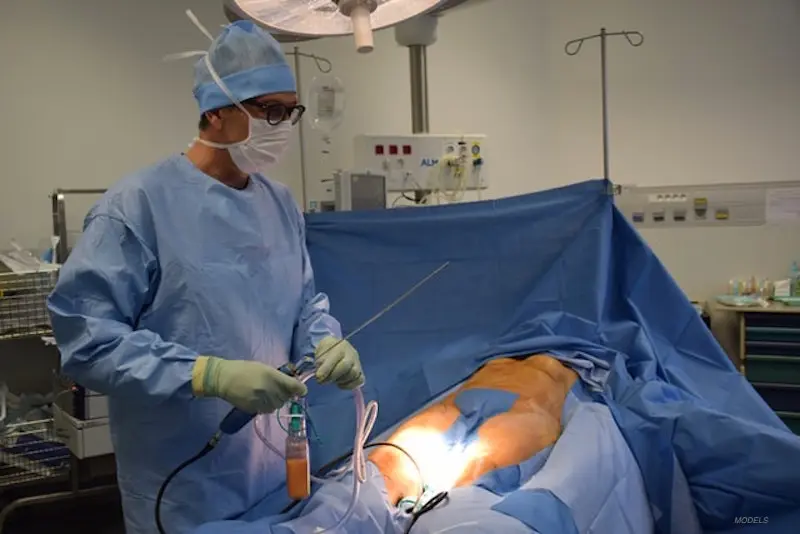 Inside the Operating Room: Exploring the Latest Liposuction Techniques ...
